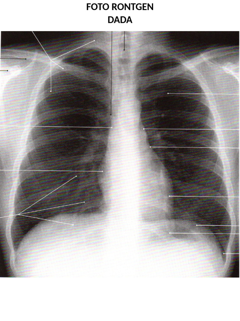 Foto Rontgen | PDF