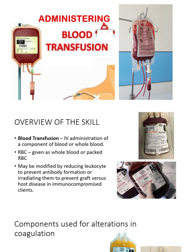 Administering-Blood-Transfusion | PDF