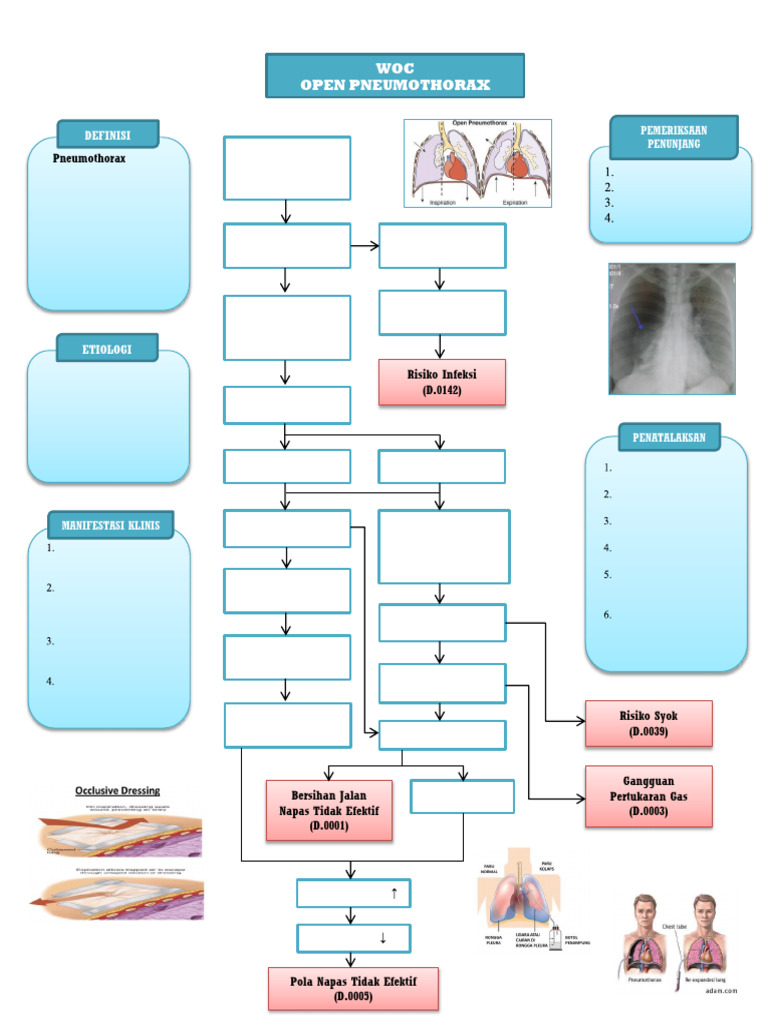 WOC Open Pneumothorax | PDF