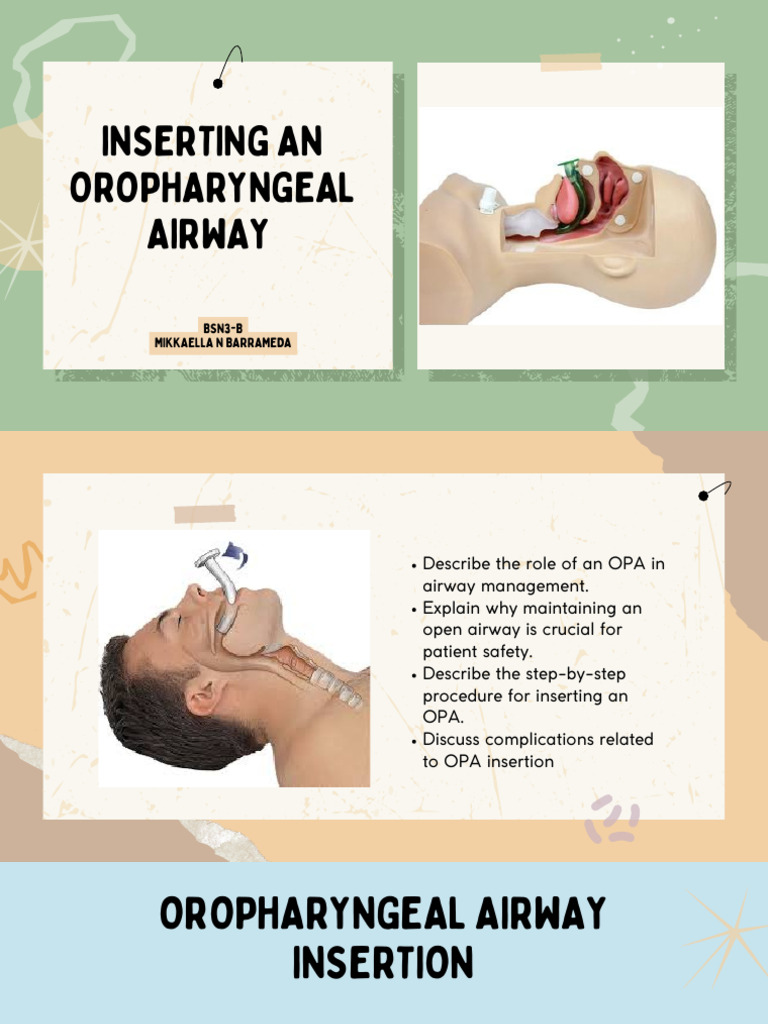 Inserting Oropharyngeal Airway_Barrameda | PDF