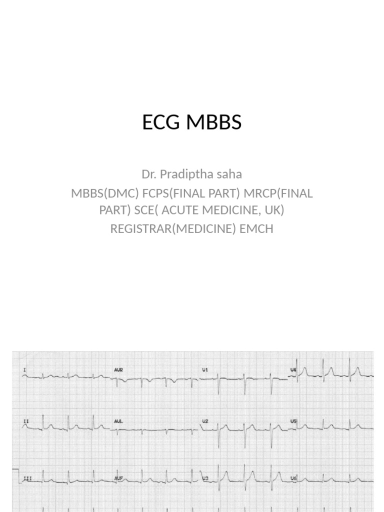 ecg mbbs | PDF
