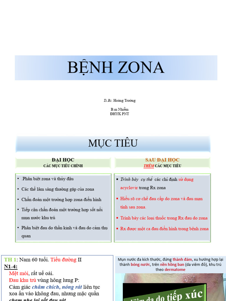 Bệnh Zona | PDF