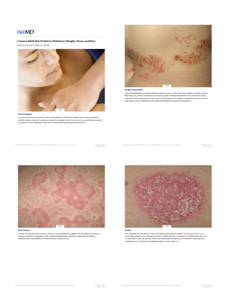 Pictures of Common Adult Skin-Problems- Identify Rashes, Eczema and More | PDF