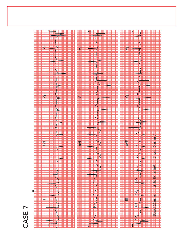 Making Sense of The Ecg:: Cases For Self-Assessment | PDF