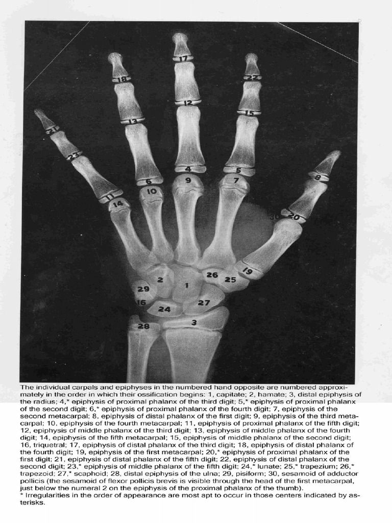 Bone Age - Greulich - Pyle Hand Wrist Atlas | PDF