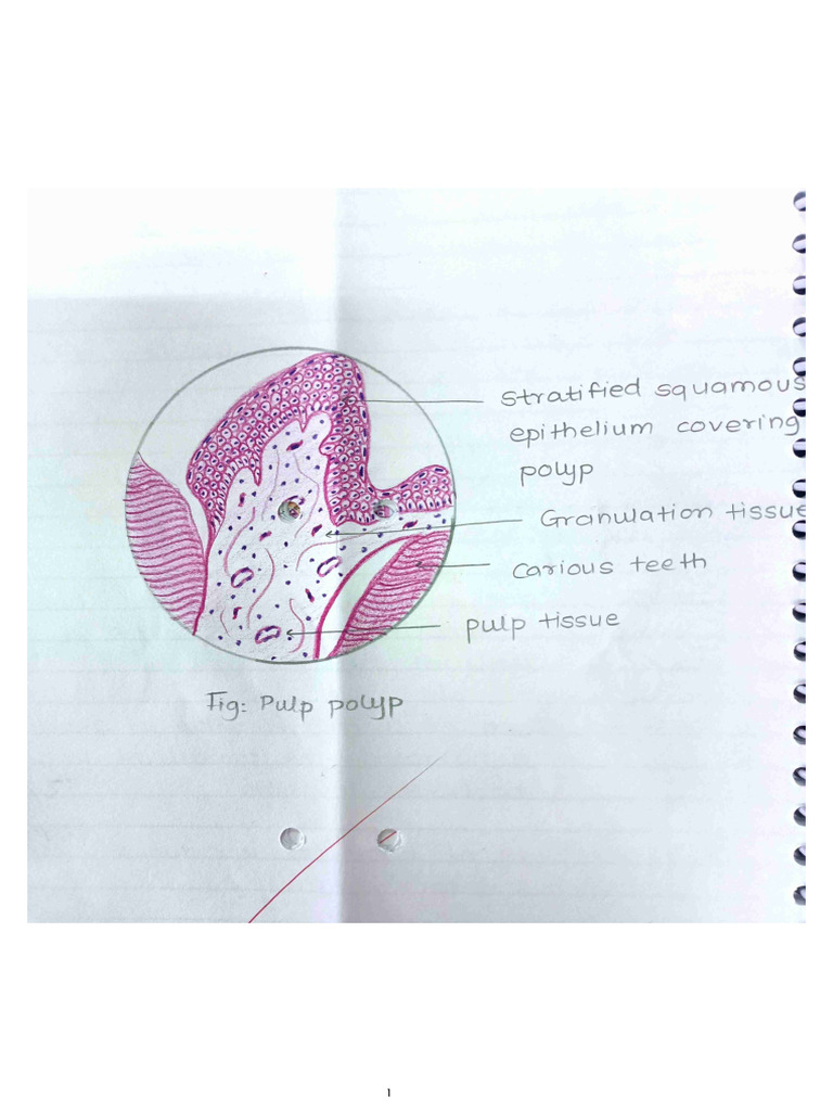 Diseases Pulp & Periapical Tissue | PDF