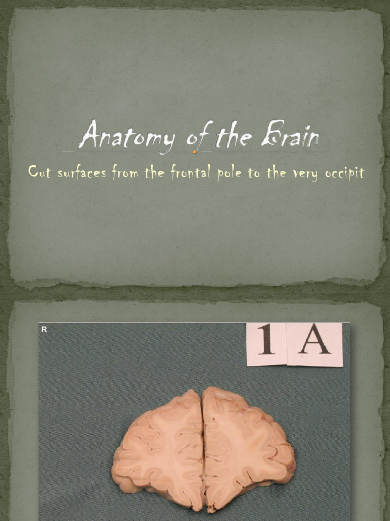 Anatomy-of-the-brain | PDF