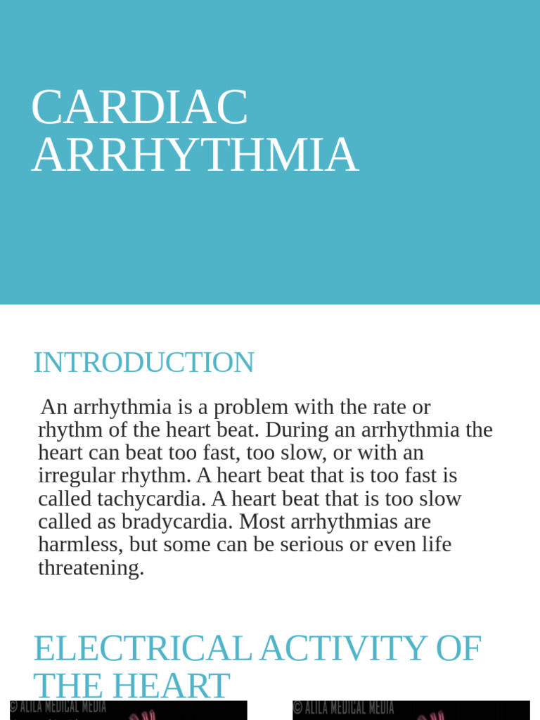 Cardiac Arrhythmia | PDF