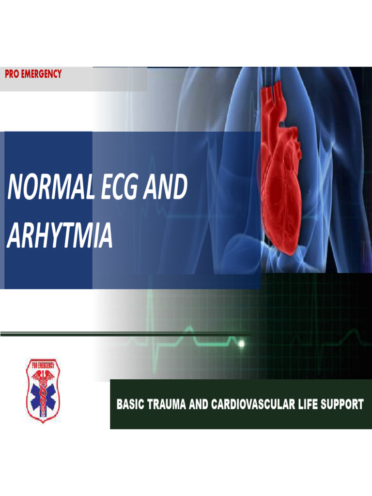 Normal ECG & Arrythmia | PDF