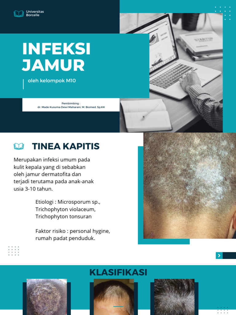 Topik 3 - Infeksi Jamur | PDF