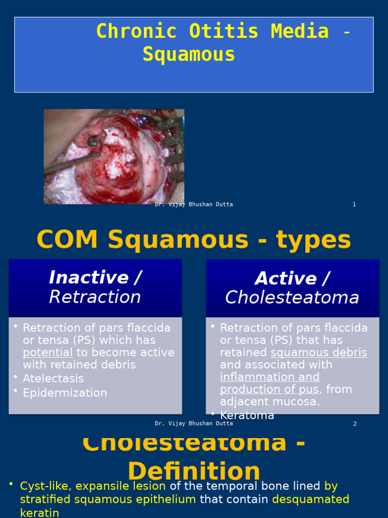 Chronic Otitis Media Squamous: 1 Dr. Vijay Bhushan Dutta | PDF
