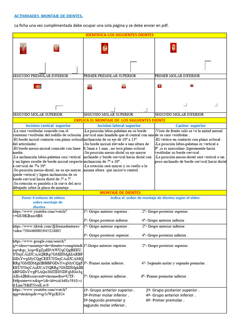 Montaje de Dientes Completo | PDF | Anatomia dental | Diente