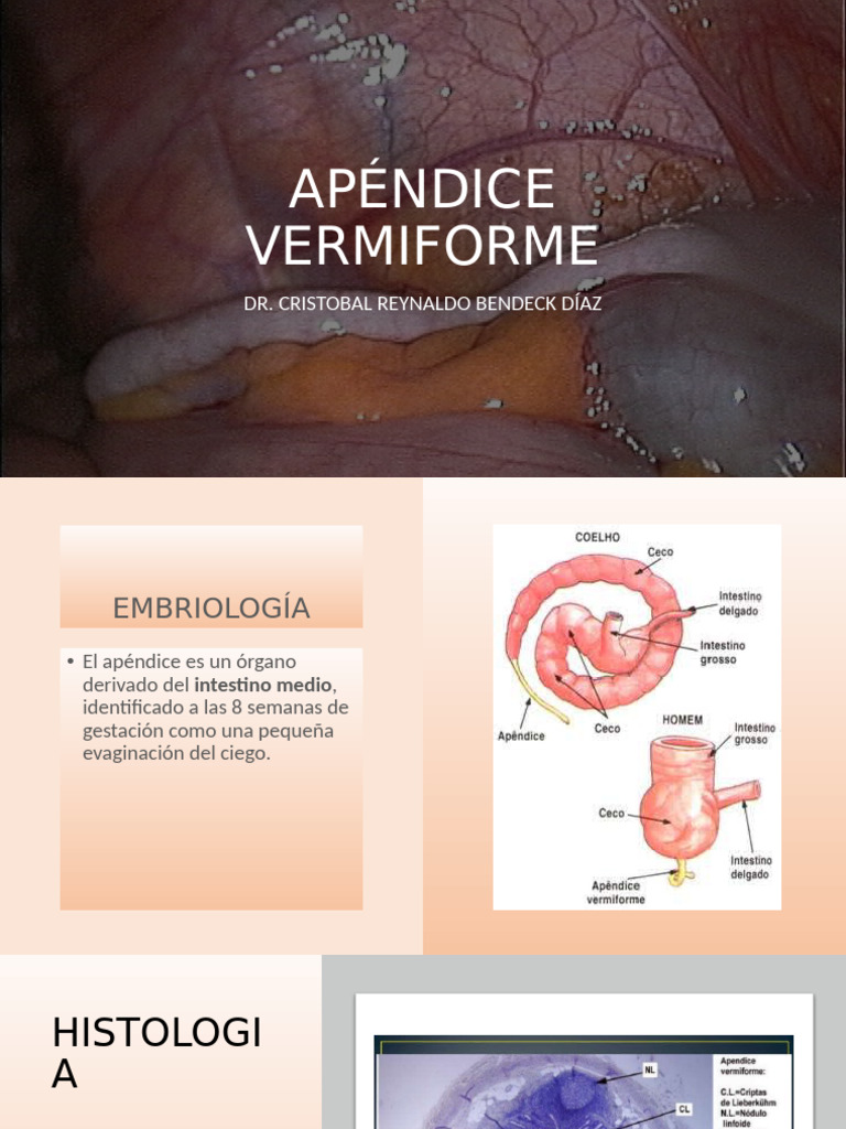 Apendice Cecal | PDF