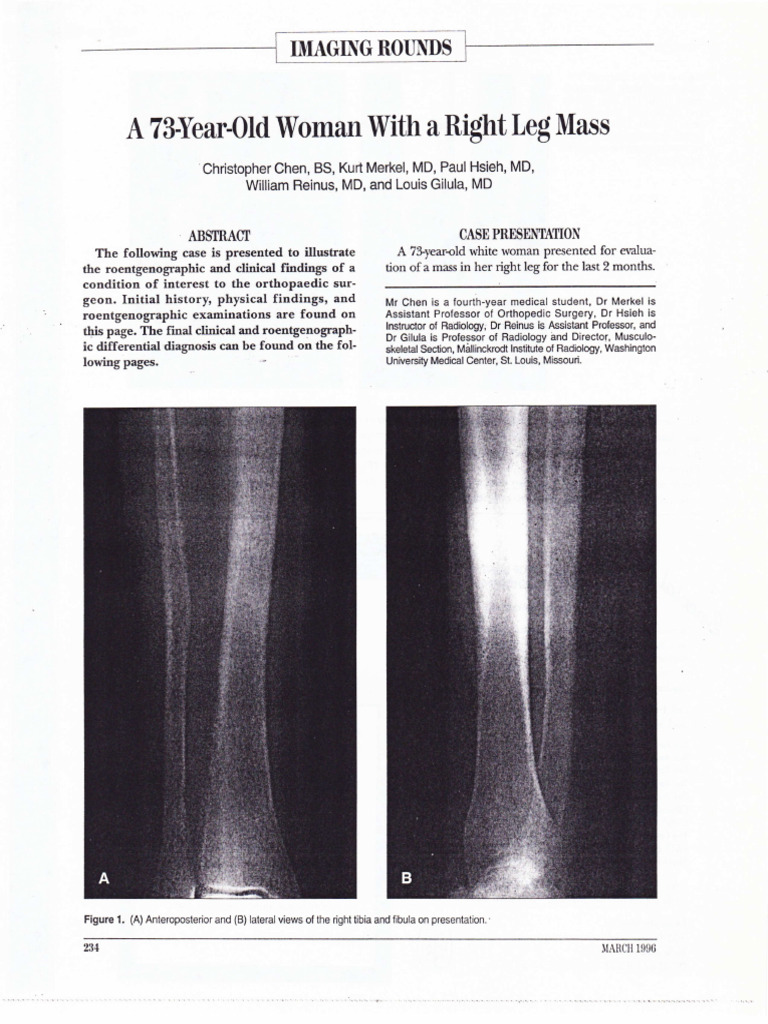 A 73 Year-Old Woman With A Right Leg Mass | PDF