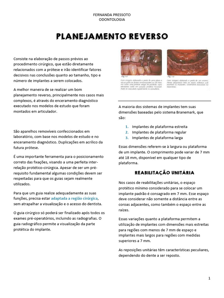 Planejamento Reverso | PDF