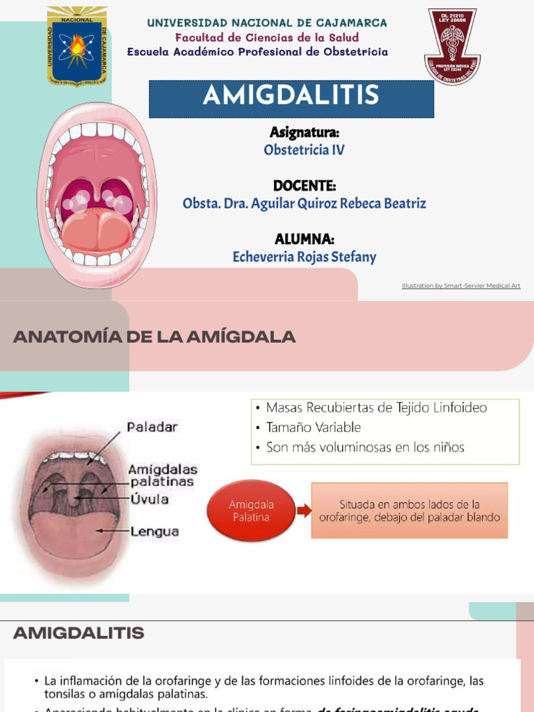 AMIGDALITIS | PDF