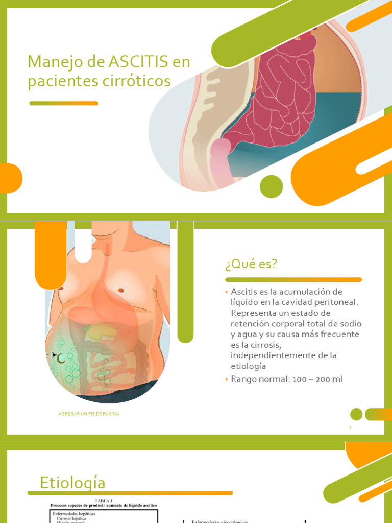 Manejo de ASCITIS en Pacientes Cirróticos | PDF