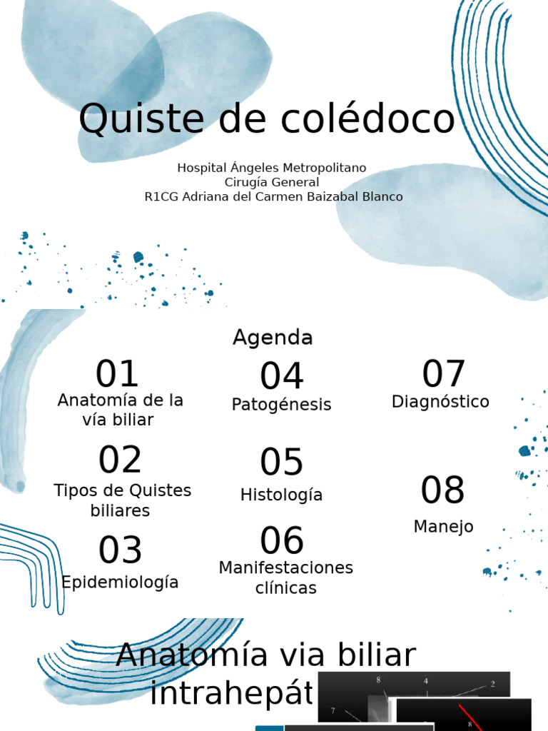Quiste de Coledoco | PDF