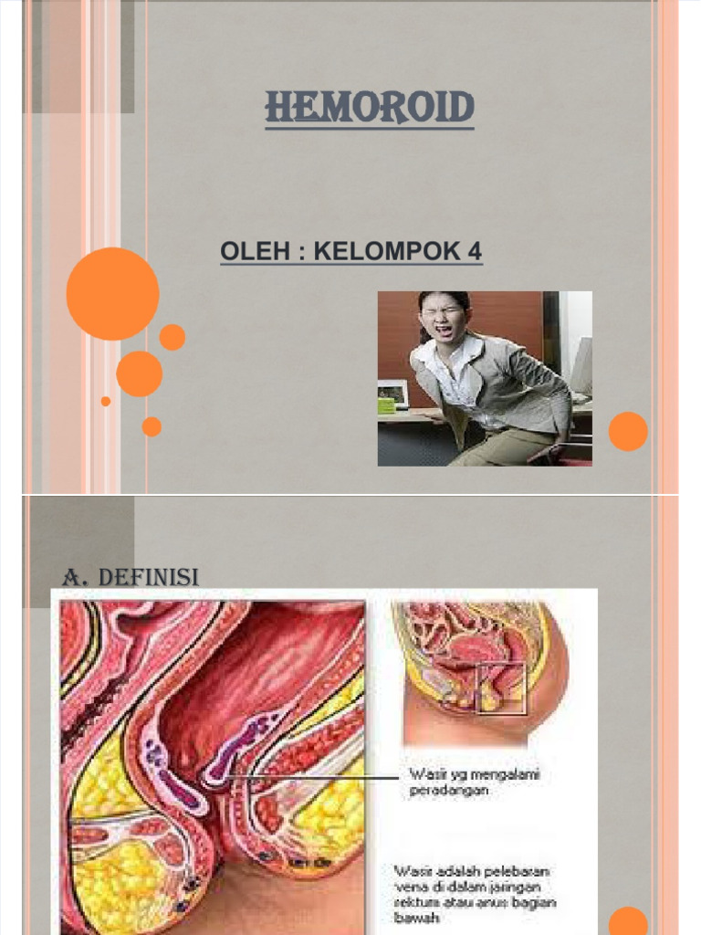 Dokumen - Tips - PPT Hemoroid KLP Ku | PDF
