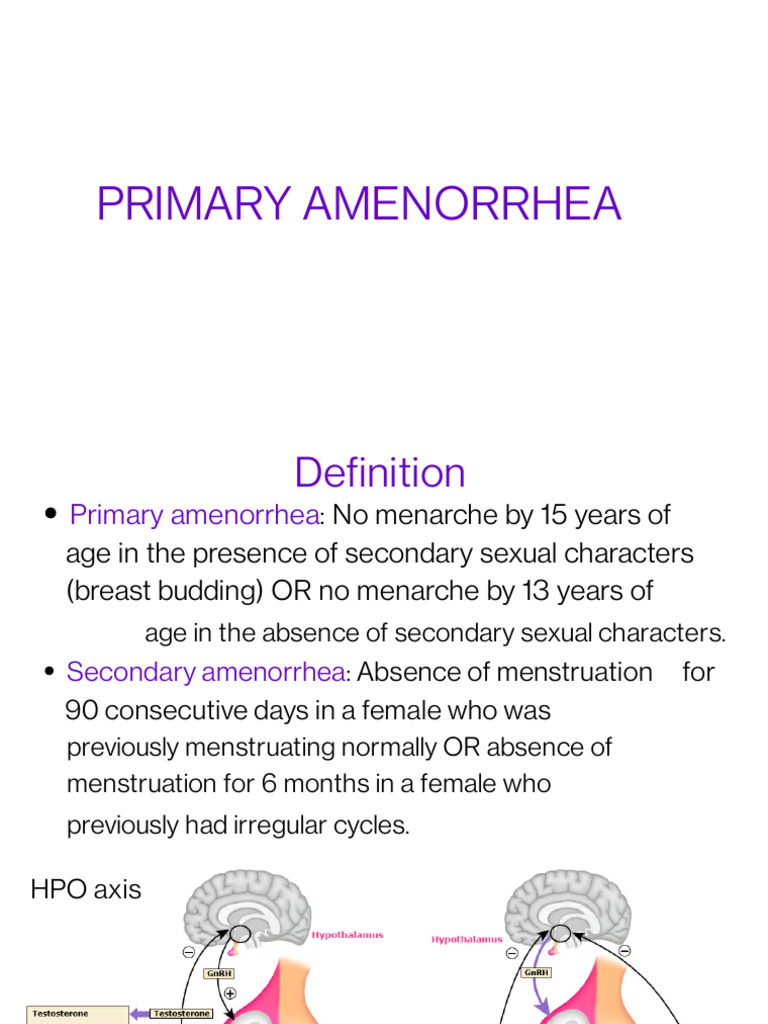 Primary Amenorrhea 1 | PDF