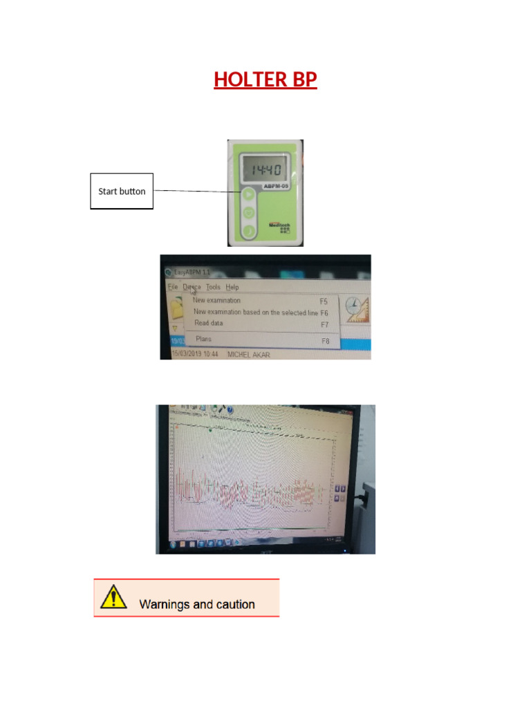 Holter BP Technical Sheet | PDF