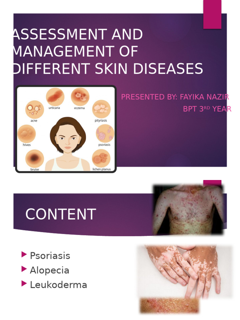 Assessment and Management of Different Skin Diseases | PDF | Psoriasis ...