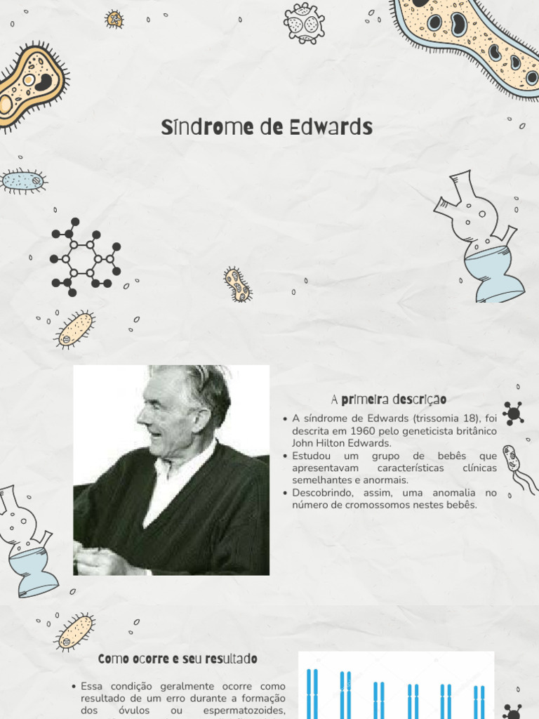 Sindrome de Edwards | PDF