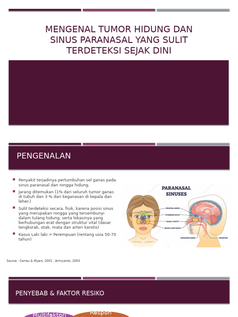 Mengenal Tumor Hidung Dan Sinus Paranasal-1 | PDF