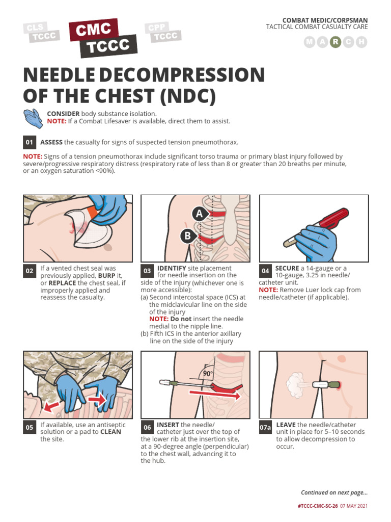 Skill Card Needle Decompression of The Chest NDC en | PDF