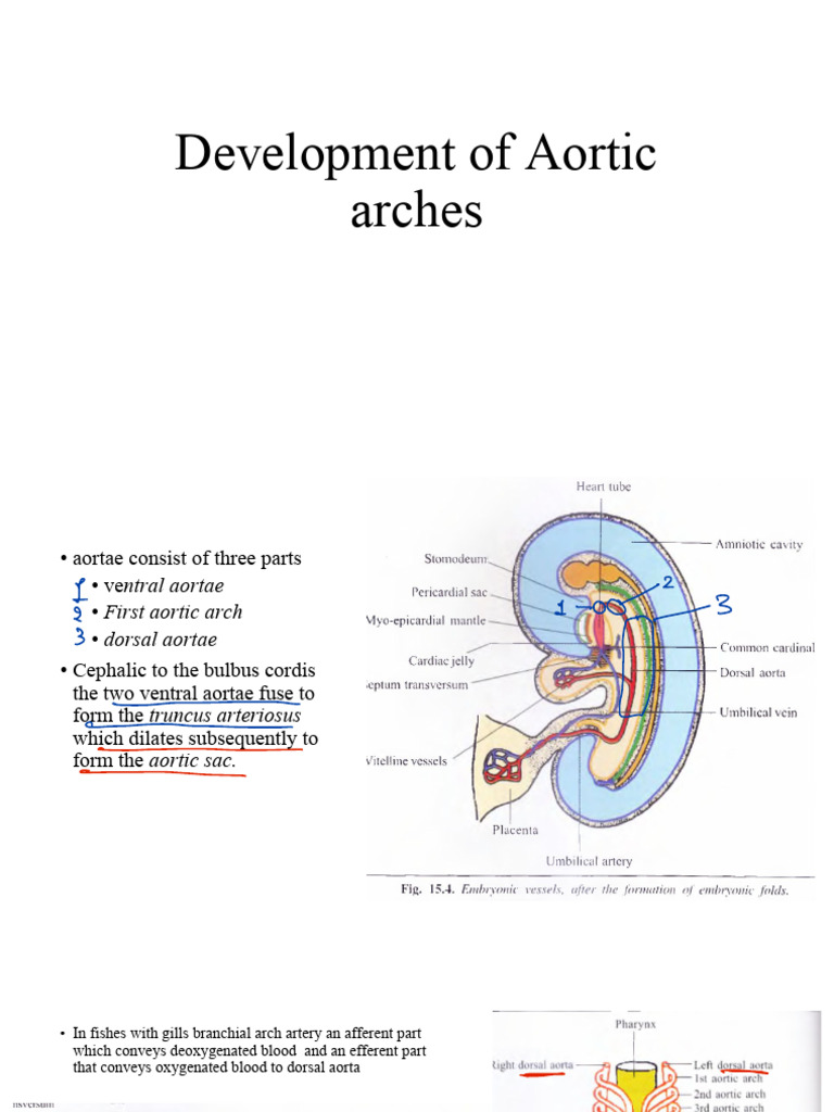 Dev of Aortic Arches | PDF
