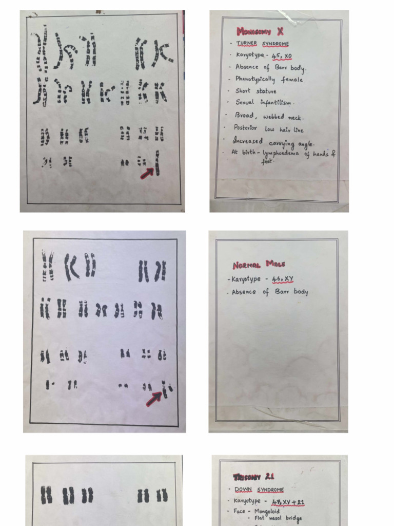 Genetics + Flashcard | PDF