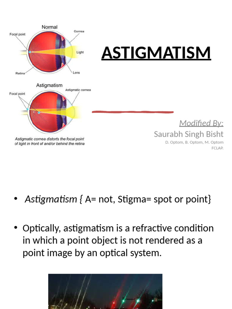 ASTIGMATISM | PDF