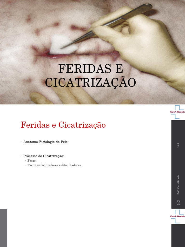 Feridas | PDF