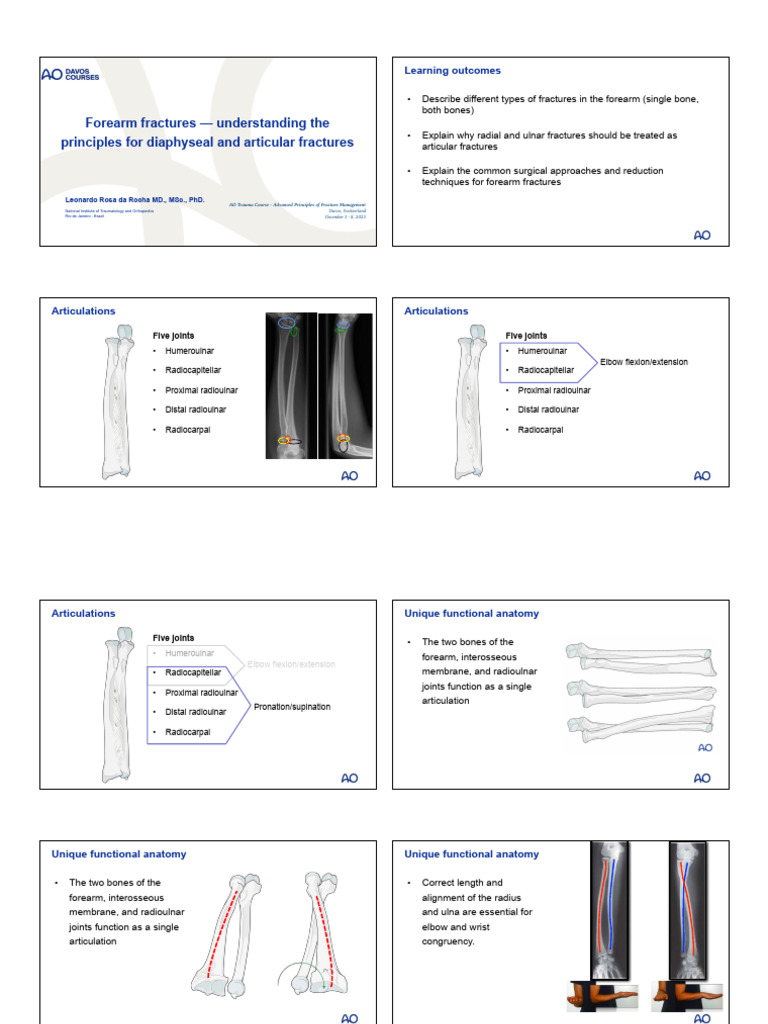 Forearm Fractures | PDF