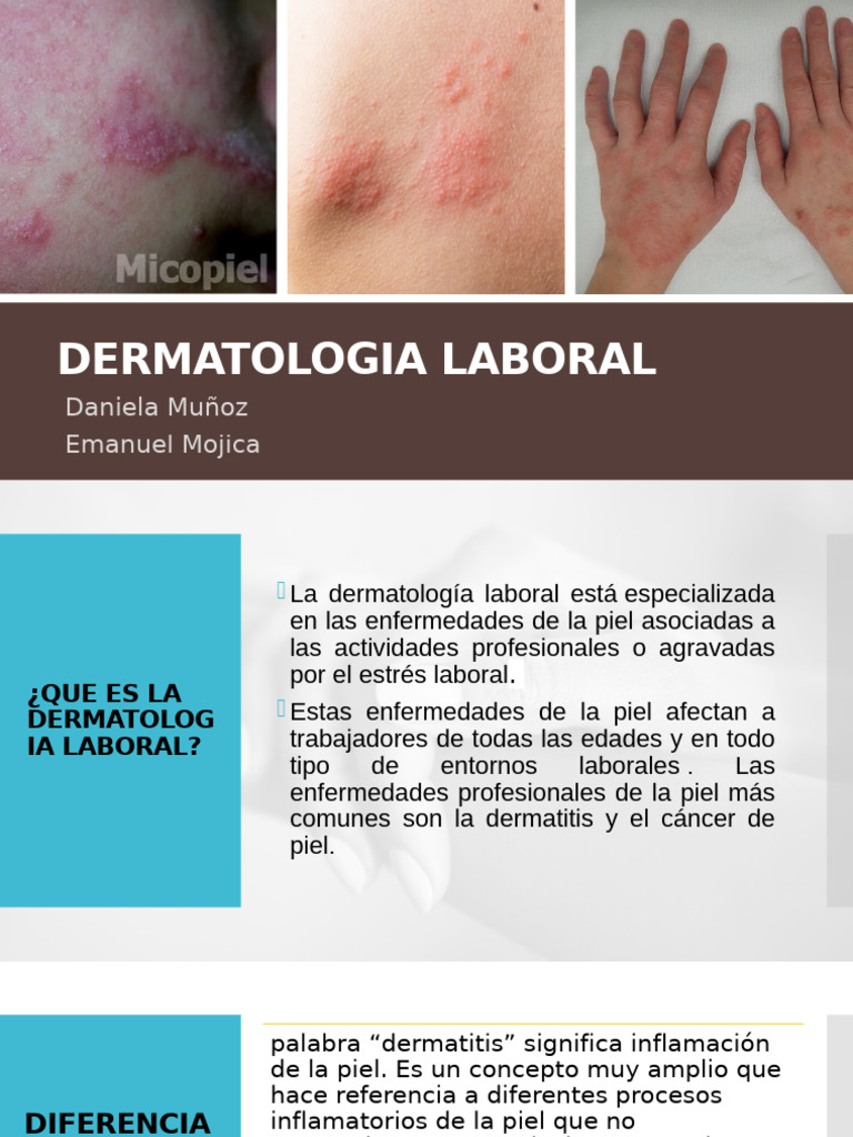 Dermatitis y Dermatosis Laboral | PDF | Alergia | Dermatología