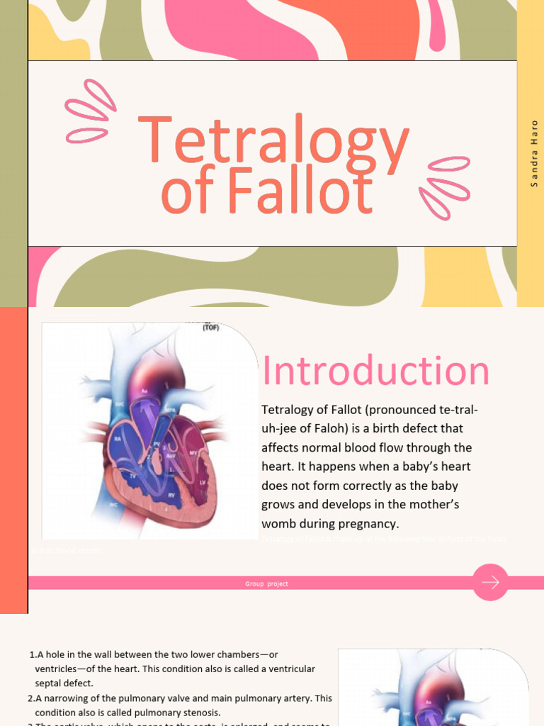 Tetralogy of Fallot (1) | PDF