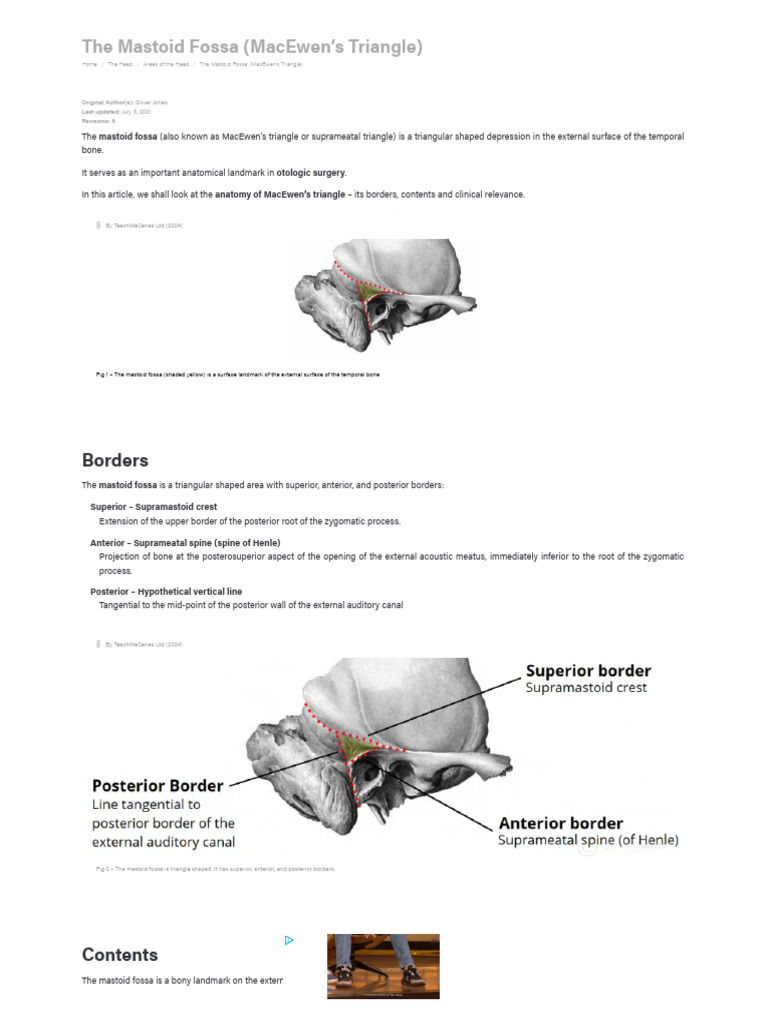 The Mastoid Fossa - MacEwen's Triangle - Borders - Contents ...