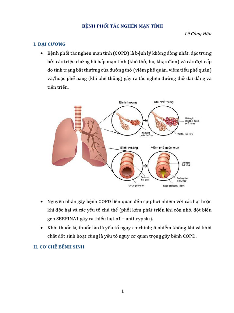 Copd | PDF
