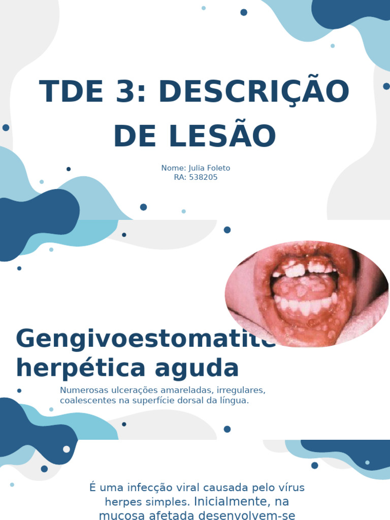 Tde 3 Estomatologia | PDF