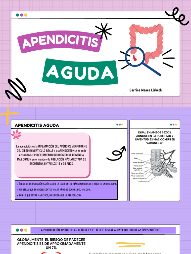 Apendicitis Aguda | PDF