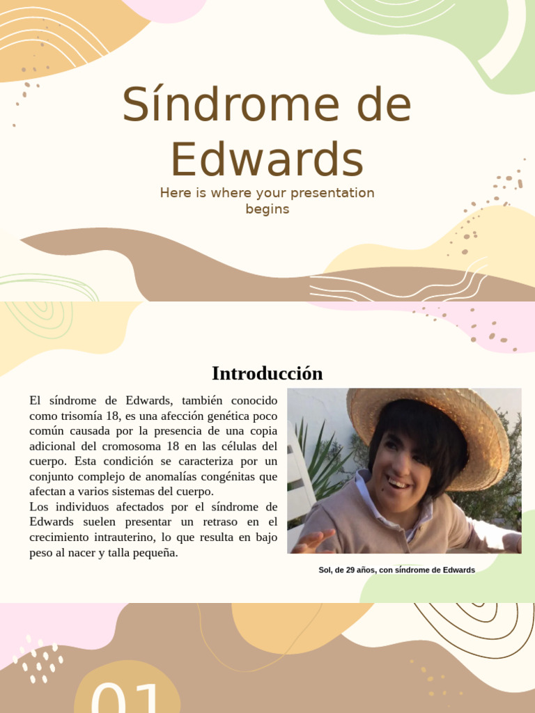Sindrome de Edwards | PDF