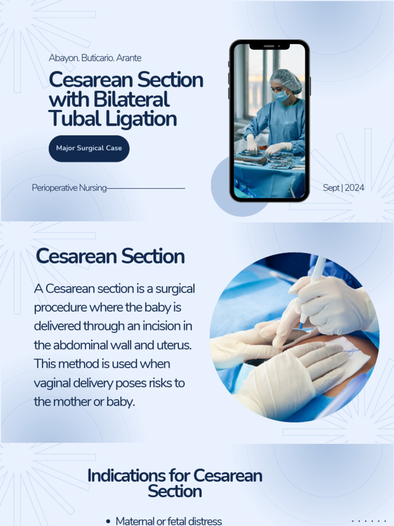 CS With Bilateral Tubal Ligation | PDF