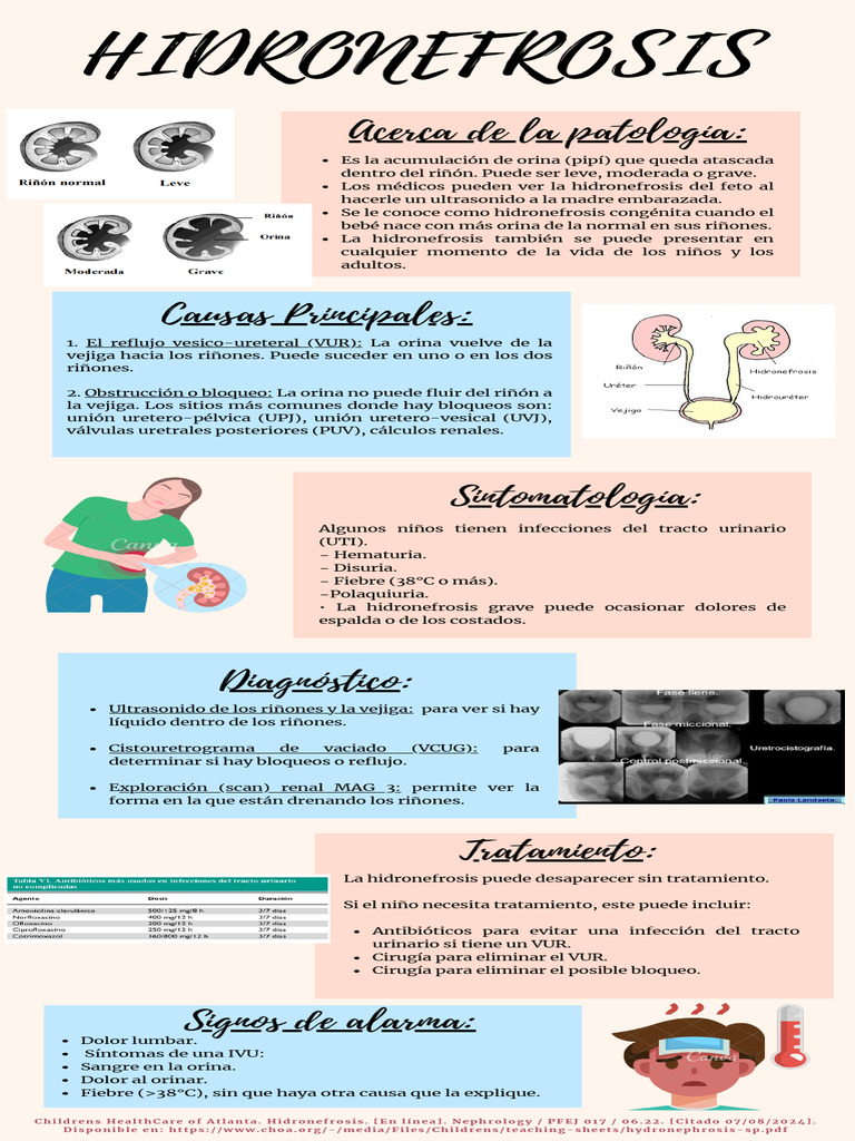 Infografía Hidronefrosis | PDF