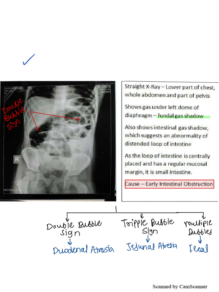 Surgery X-Rays | PDF