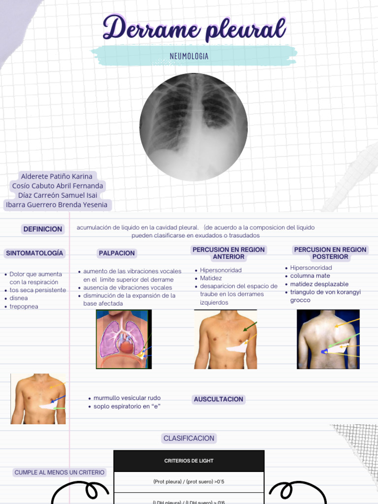Derrame Pleural | PDF