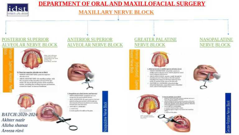 Maxillary Nerve Block Techniques | PDF