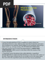 DVT: Acute vs Chronic Documentation | PDF | Thrombosis | Vein