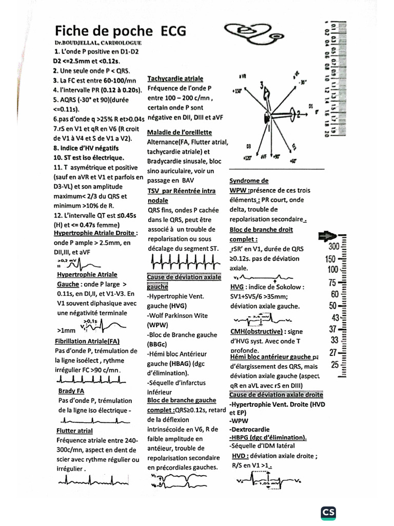 ECG - Fiche de Poche DR Boudjlel | PDF
