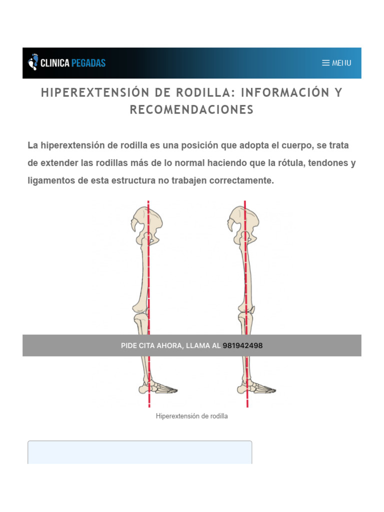 Hiperextensión de Rodilla - Información y Recomendaciones - Clínica ...
