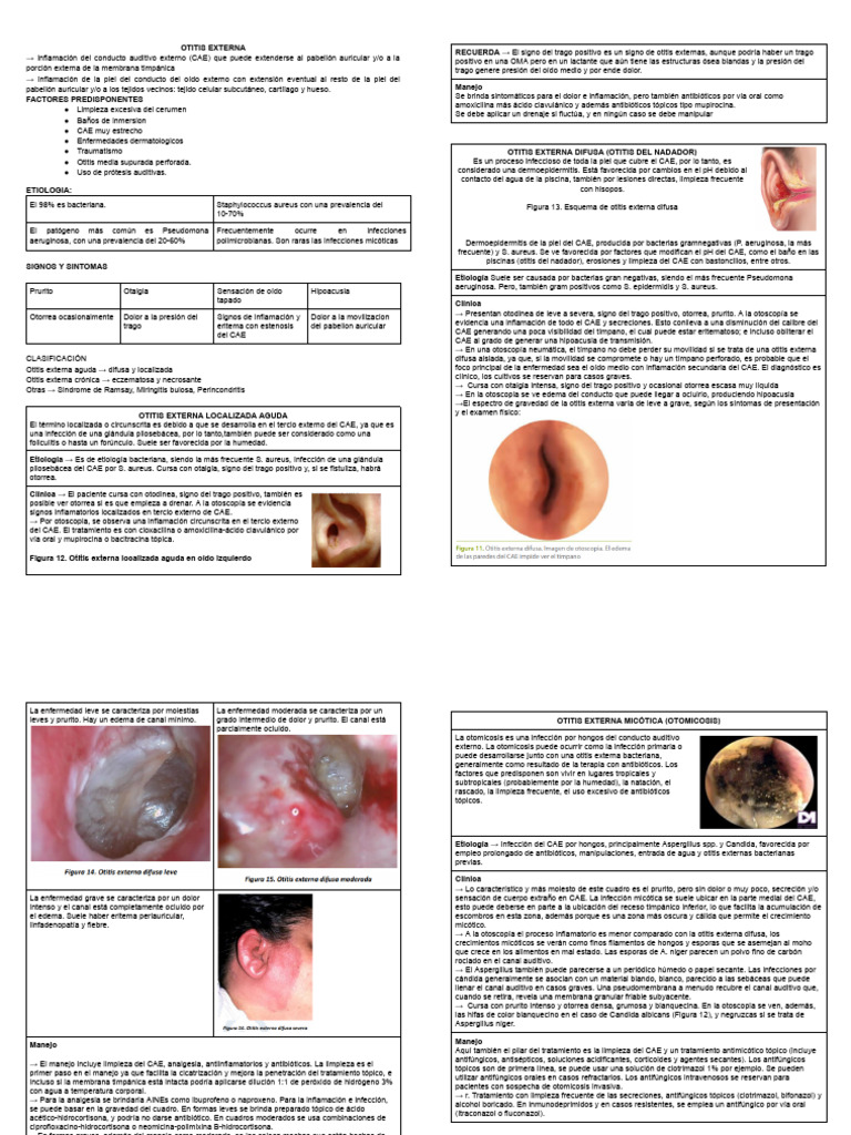 Ecoe-Otitis Externa - PDF 2 | PDF